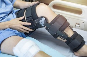 ACL Tears | Motion Orthopaedics
